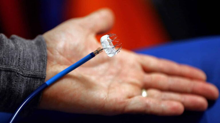 Comprehensive Guide to The Watchman Implant Procedure | CVG Cares ...