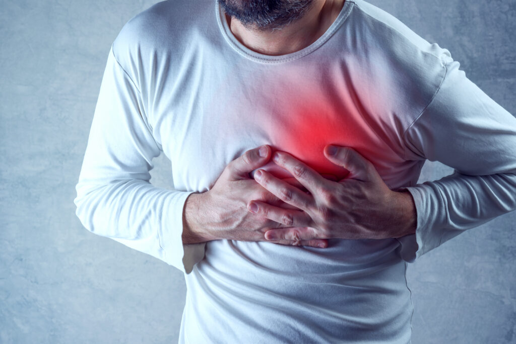 Expert Heart Attack Information, Symptoms & Treatment | CVG Cares ...