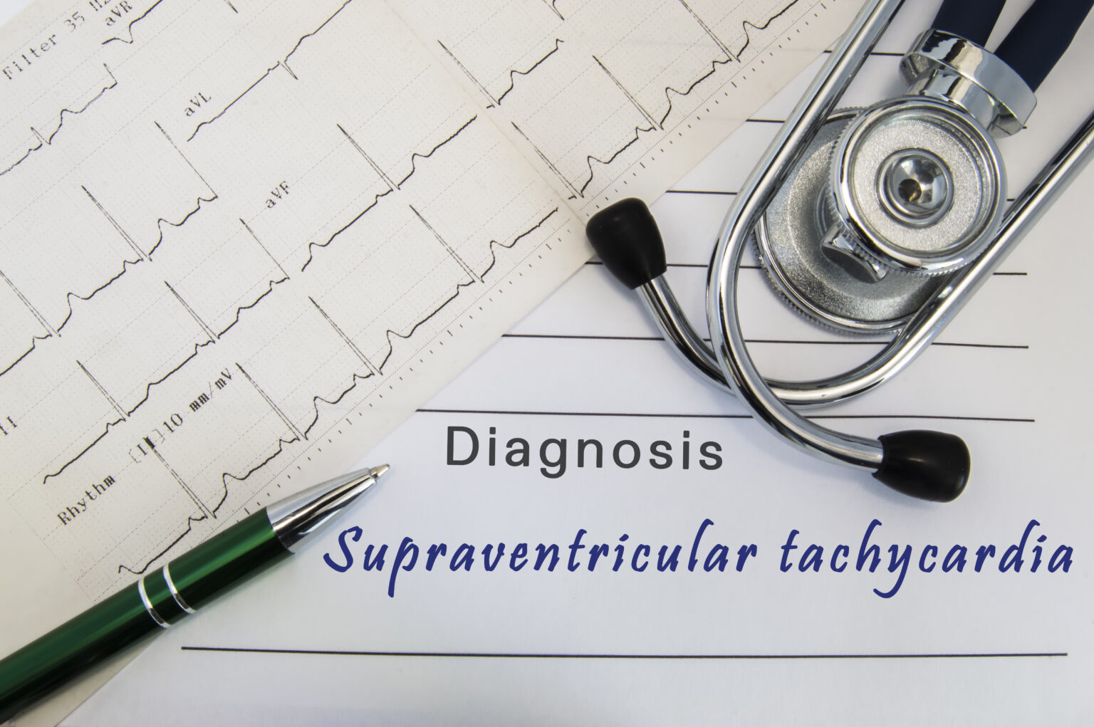 Understanding Tachycardia: Causes, Symptoms & Treatment | CVG Cares ...